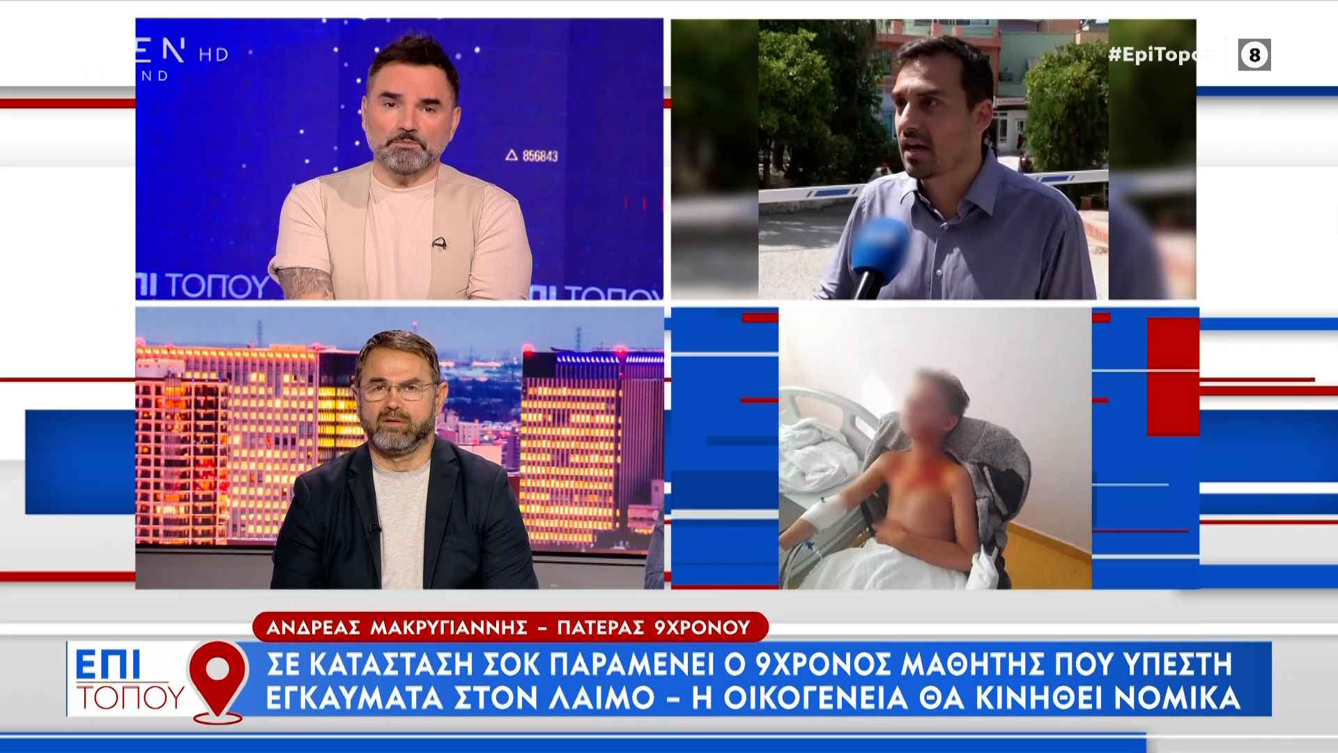 Μαθητής στην Πάτρα υπέστη σοβαρά εγκαύματα από βεγγαλικό σε σχολική ...