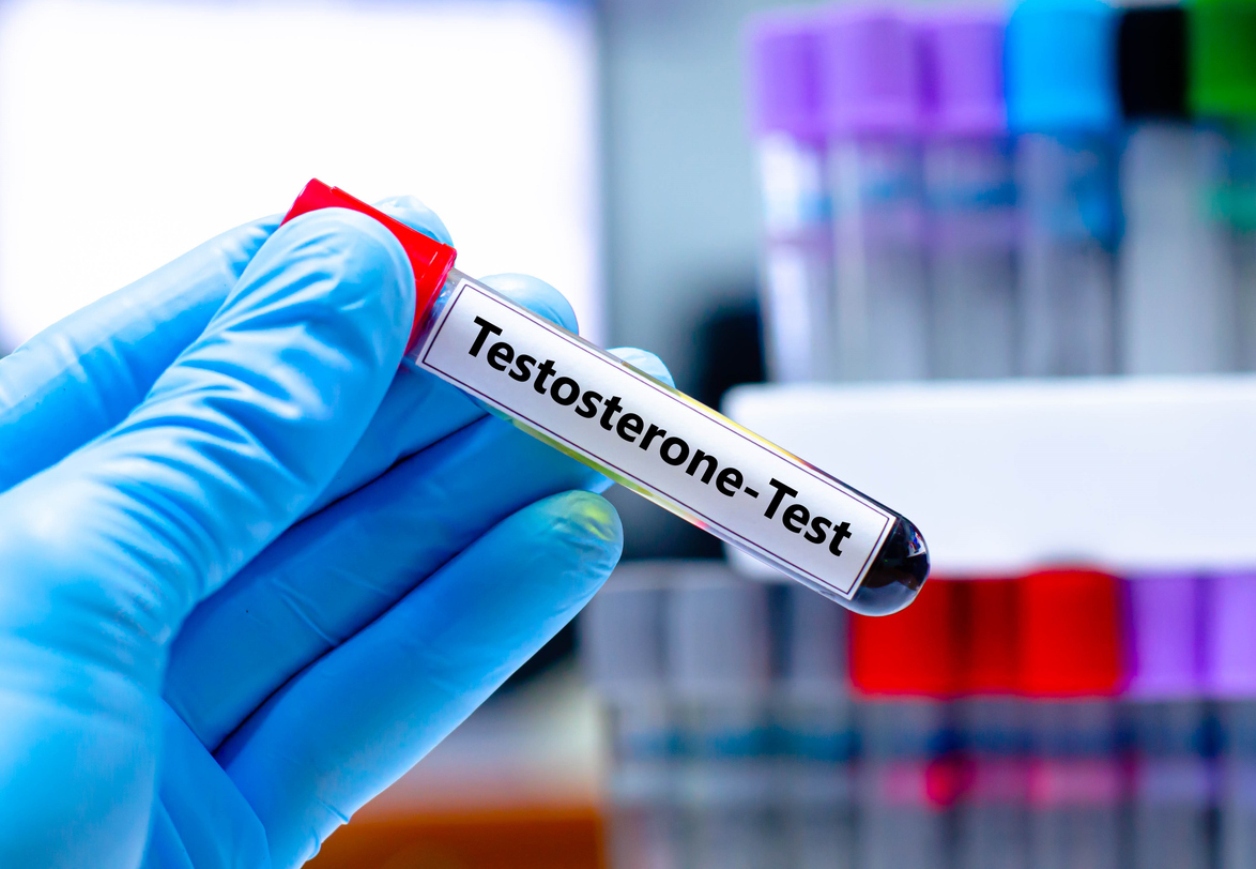 Τεστοστερόνη: Τι είναι και ποια είναι τα φυσιολογικά επίπεδα σε άνδρες ...