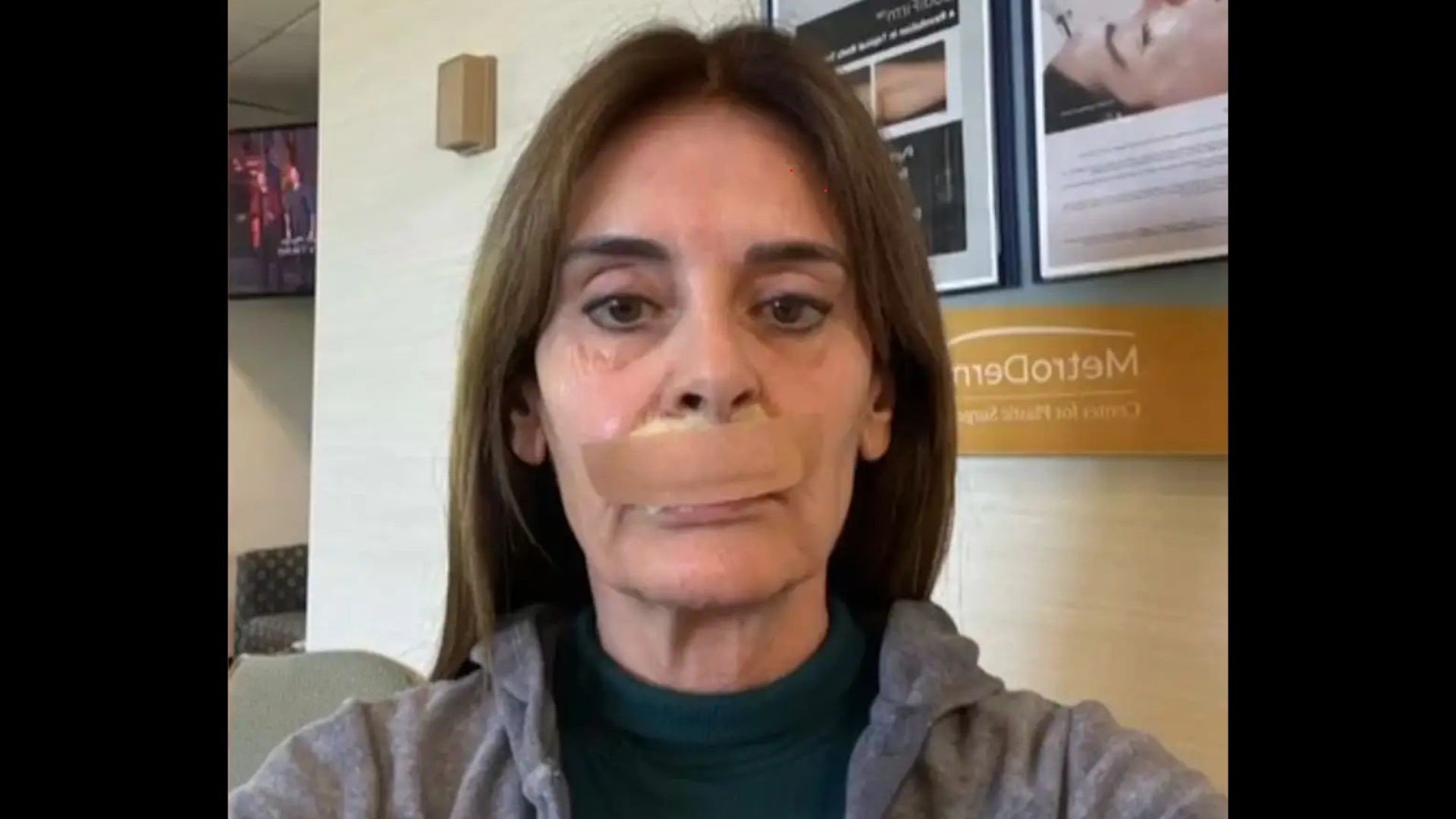 Κατερίνα Πλουμιδάκη: «Έκανα το 21ο χειρουργείο, πήραν λίπος από τον ...