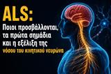 ALS: Ποιοι κινδυνεύουν, τα πρώτα σημάδια και πώς εξελίσσεται η νόσος ...